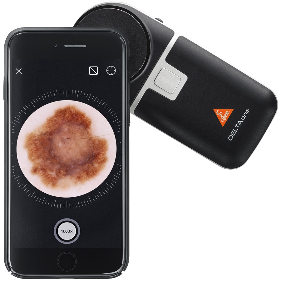 Coque d’adaptation iPhone pour dermatoscope HEINE DELTAone
